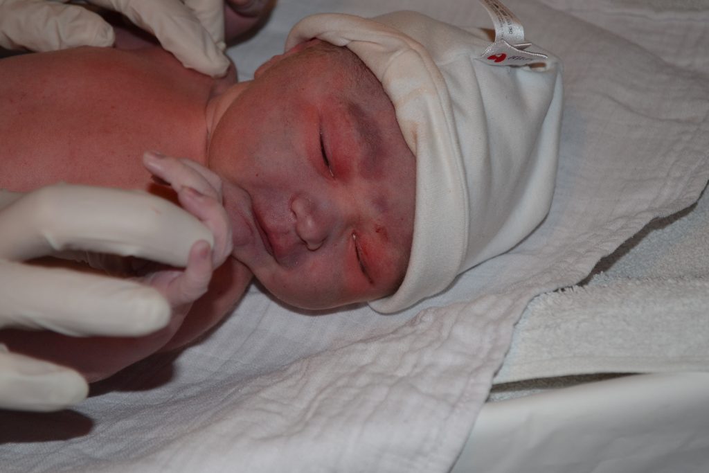 naitbabies.org | NAIT neonatal alloimmune thrombocytopenia