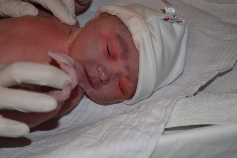 naitbabies.org – NAIT neonatal alloimmune thrombocytopenia